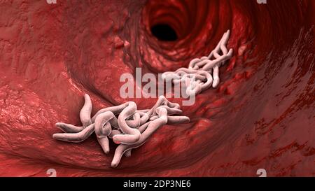 Ascaris nematode worms. Artwork of the human intestines cutaway to ...