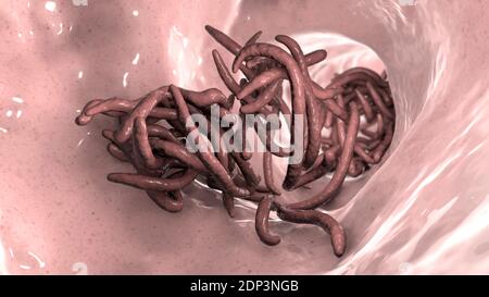 Ascaris nematode worms. Artwork of the human intestines cutaway to ...