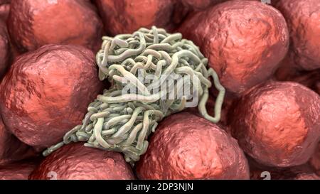 Round worms in human intestine, computer illustration. Roundworms, or ...