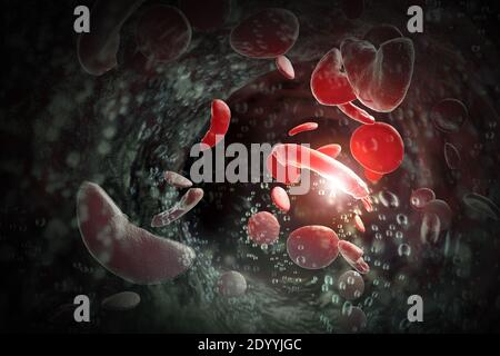 Sickle cell anemia disease (SCD) blood cells 3D illustration Stock ...
