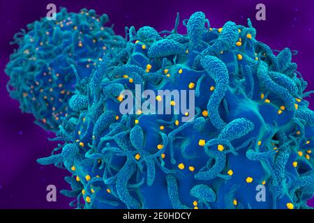 Hiv virus attack and infected t-cell 3d render illustration Stock Photo ...