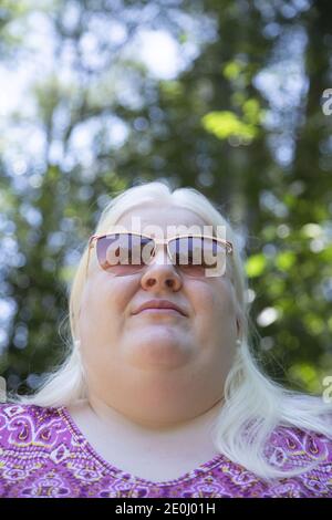 Close up of an albino woman wearing a medical mask Stock Photo - Alamy