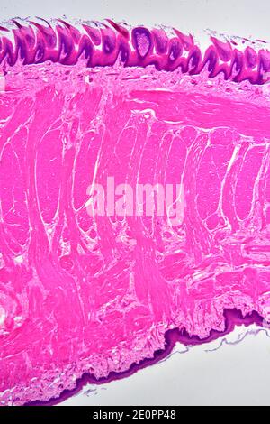 Filiform papillae in a tongue longitudinal section. X25 at 10 cm wide ...
