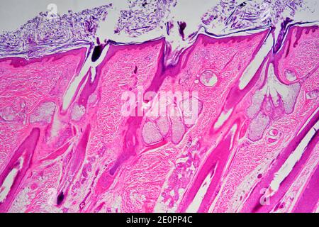 Skin with hair follicles. Light micrograph of a transverse section ...