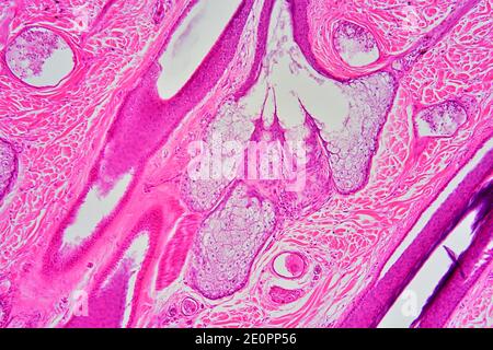Human skin showing sebaceous gland, blood vessels and hair follicle ...
