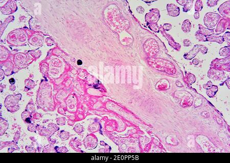 Human placenta with chorionic villi, blood vessels and red blood cells ...