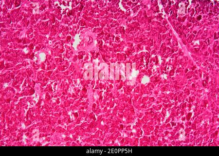 Human Histology, section of pancreas, light photomicrograph Stock Photo ...