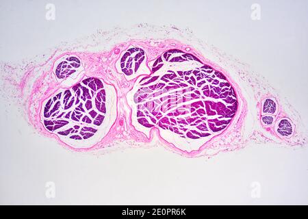 Peripheral nerve. Light micrograph of a cross section through an osmium ...