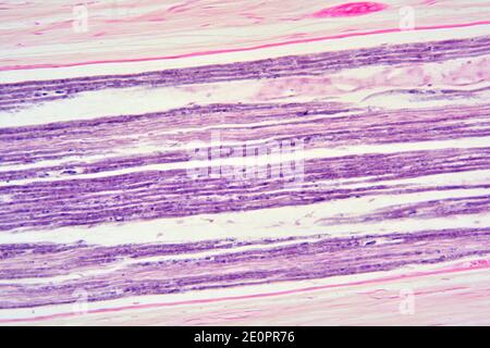Sciatic nerve. Light micrograph of a longitudinal section through a ...