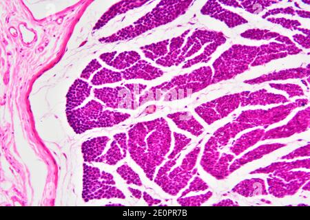 Peripheral nerve, light micrograph Stock Photo - Alamy