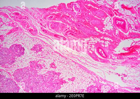 Human umbilical cord mucosa showing: mucous glands, loose conective ...
