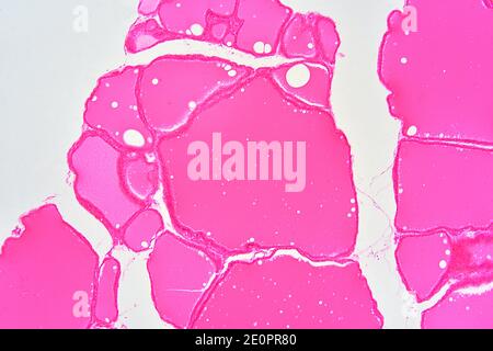 Human thyroid gland section showing colloid and follicular cells. X75 ...