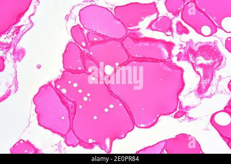 Human thyroid gland section showing colloid and follicular cells. X75 ...