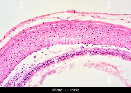 Hyaline Cartilage Trachea Slide