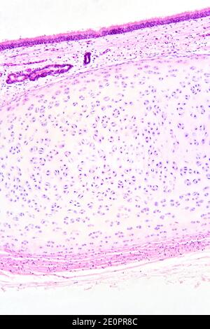 Chondrocytes, light micrograph Stock Photo - Alamy