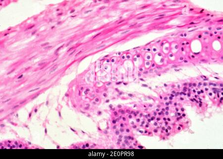 Hyaline cartilage. Light micrograph of a section through hyaline ...
