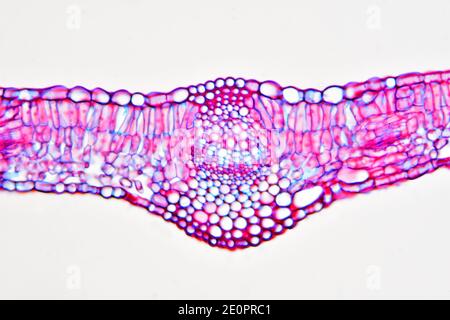 Leaf section of Syringa sp. showing from up to down: cuticle, upper ...