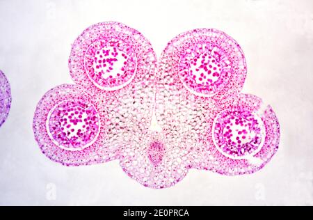 Light photomicrograph of Lily anther cross section seen through ...