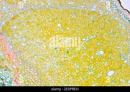 The Bacteria, Bradyrhizobium japonicum in a Soybean root nodule ...