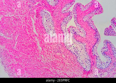 Urinary bladder with urothelium (transitional epithelium), connective ...