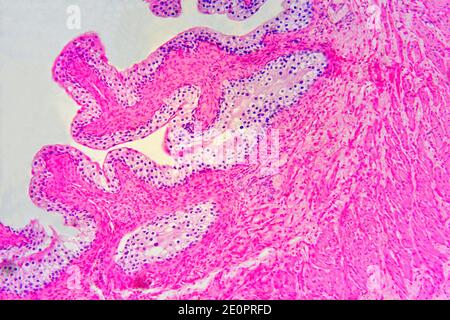 Urinary bladder with urothelium (transitional epithelium), connective ...