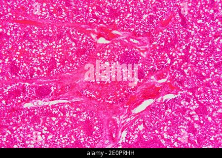 Human lymph node or lymph gland. Photomicrograph Stock Photo - Alamy