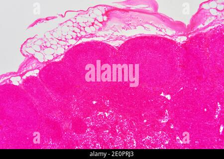 Lymph node or lymph gland with capsule, lymphoid nodule and trabeculae ...