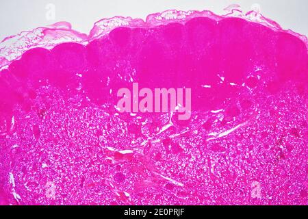 Lymph node or lymph gland with capsule, lymphoid nodule and trabeculae ...