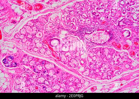 Mucous Connective Tissue Stock Photo - Alamy
