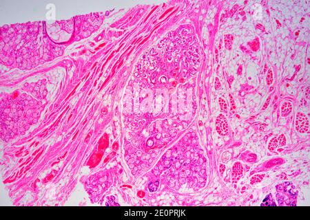 Parotid gland is the bigger salivary gland. We can see mucous gland ...