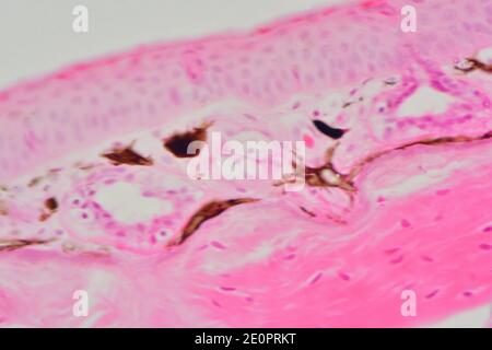 Frog skin showing epidermis, pigmentary layer with melanocytes (brown ...