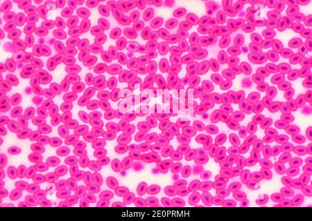 Snake blood. Red blood cells with nucleous. Photomicrograph X150 at 10 ...