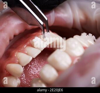 Dental care. Dentistry concept. Perfect healthy teeth. Closeup shot of ...