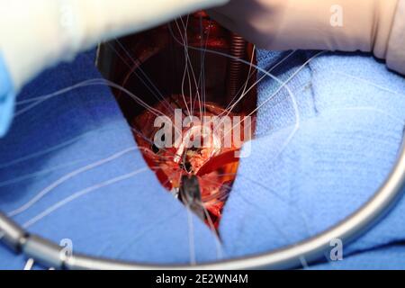 Medicine and health concept. Syringe, human figure made of pills and ...