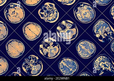 Head MRT. MR image of human brain Stock Photo - Alamy