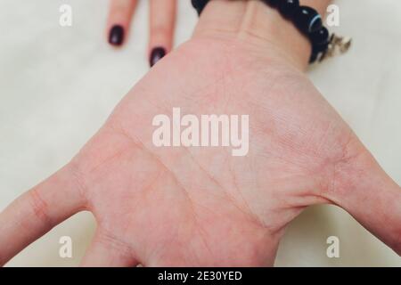 simian palm line Stock Photo - Alamy