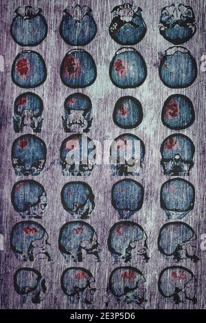 Steel brain. Iron Brain Stock Photo - Alamy