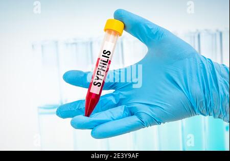 Syphilis. Syphilis disease blood test in doctor hand Stock Photo - Alamy