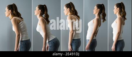 Back Pain Abdominal Posture Before And After Stock Photo - Alamy