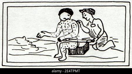 Measles Aztec drawing Stock Photo - Alamy