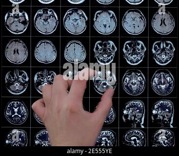 Medicine and health concept. The doctor points his finger at a sign ...