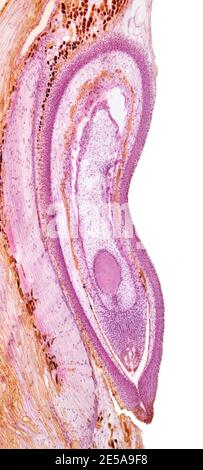 Scots Pine, Pinus sylvestris, ovule LS, brightfield photomicrograph ...