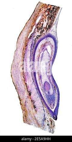 Scots Pine, Pinus sylvestris, ovule LS. brightfield photomicrograph ...