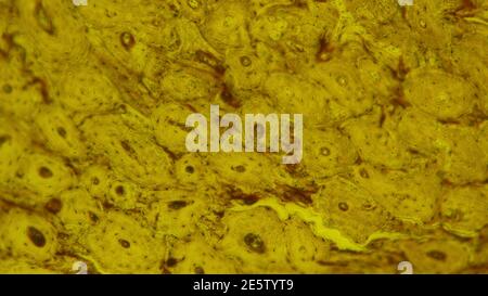 Cross section of human long bone showing trabecula bone tissue Stock ...