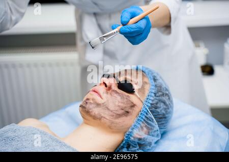 Laser photorejuvenation and carbon peeling of face for woman. Black ...