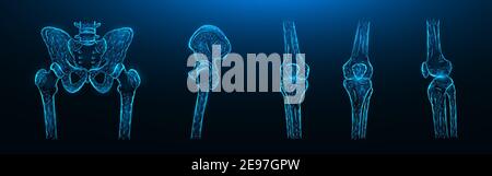 Knee joint tibia hip femur foot fracture prosthesis orthopedic vector ...