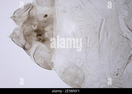 Human louse at 10 times magnification under a microscope Stock Photo ...