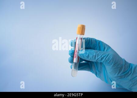Nipah virus. Young woman wearing a medical face mask holding a glass ...