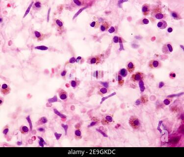 Tissue histiocytes, light micrograph Stock Photo - Alamy