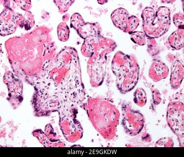 Light micrograph of small blood vessels, mostly arterioles, located in ...